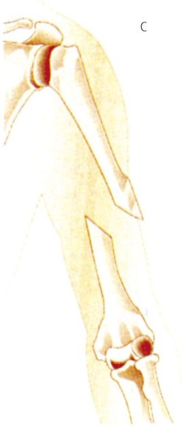 Omero: definizione e significato medico | Corriere Salute