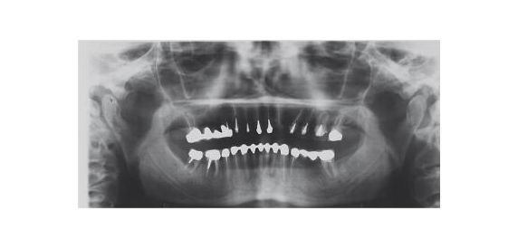 Parodonto: definizione e significato medico | Corriere Salute