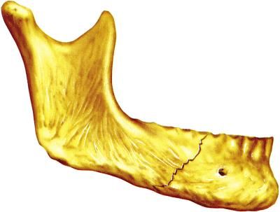 Mandibola: definizione e ultime news | Corriere Salute