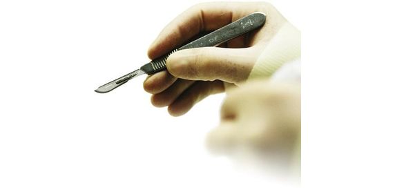 Lancetta: definizione e significato medico | Corriere Salute