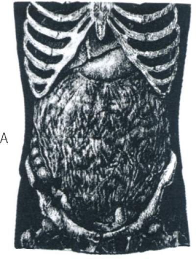 Mesentere: definizione e significato medico | Corriere Salute