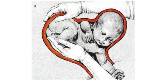 Distocia: definizione e significato medico | Corriere Salute