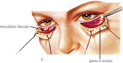 Palpebra: definizione e significato medico | Corriere Salute