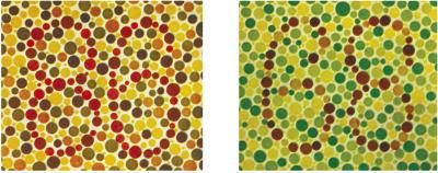 Discromatopsia: definizione e significato medico | Corriere Salute