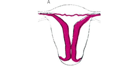 Metrorragia: definizione e significato medico | Corriere Salute