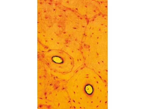 Osteone: definizione e significato medico | Corriere Salute