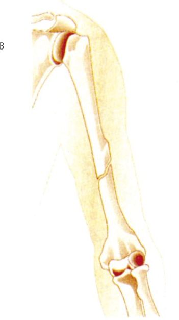 Omero: definizione e significato medico | Corriere Salute