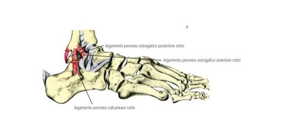 Frattura del piede: definizione e significato medico | Corriere Salute