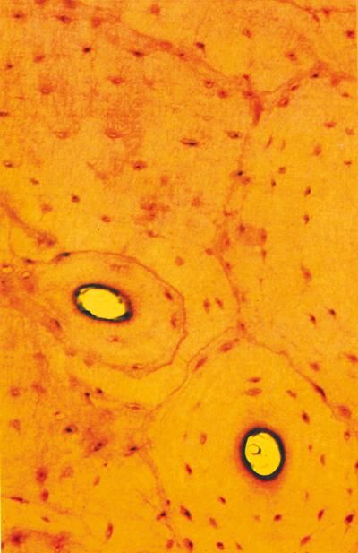 Osteone: definizione e significato medico | Corriere Salute