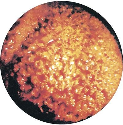 Disuria: definizione e significato medico | Corriere Salute