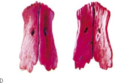 Naso: definizione e significato medico | Corriere Salute